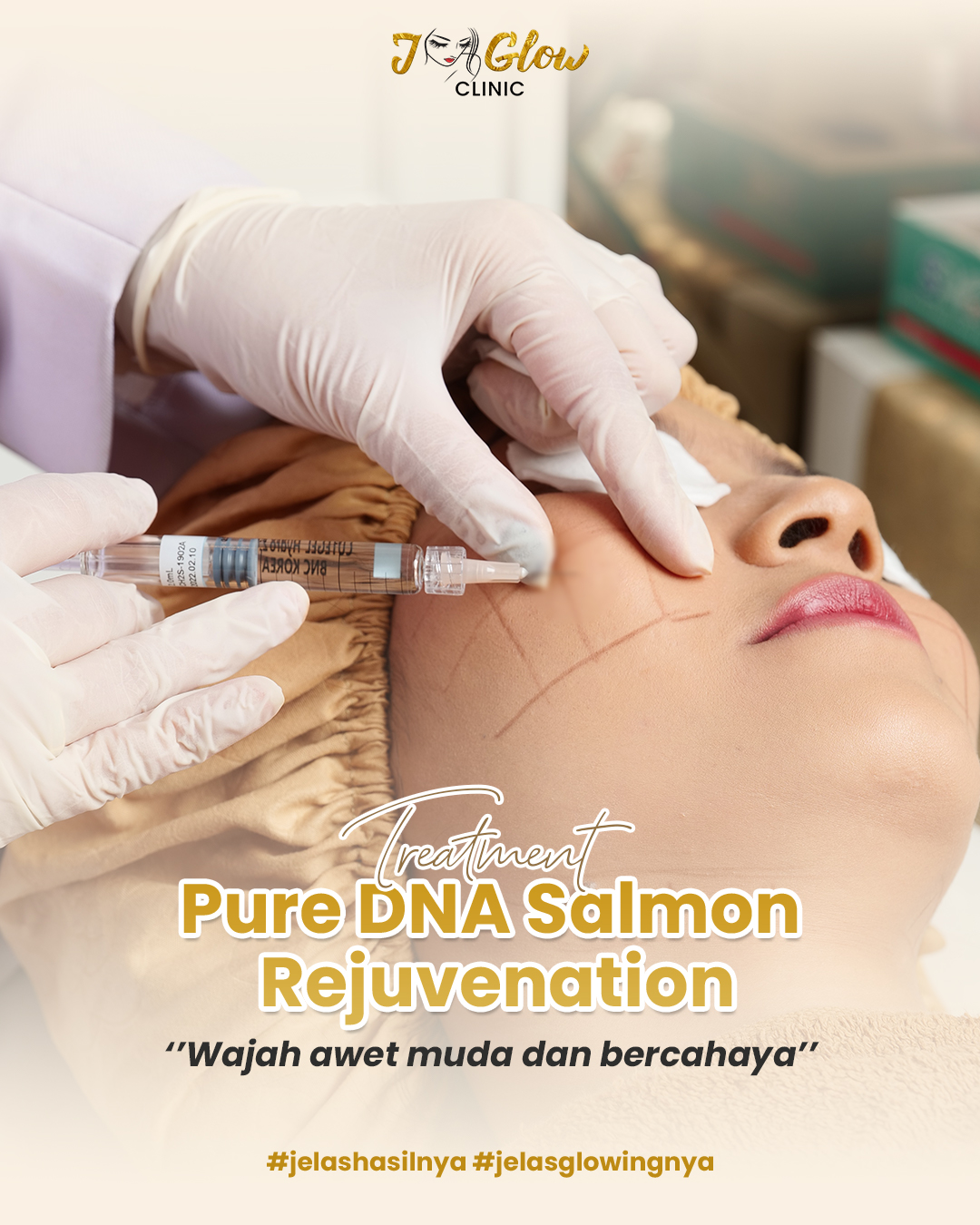 Segudang Manfaat Treatment DNA Salmon dengan JGlow Aesthetic Clinic ...